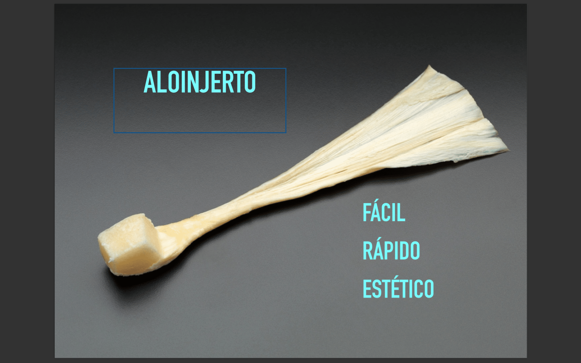 ¿Qué plastia elegir para la reconstrucción de ligamento cruzado ...