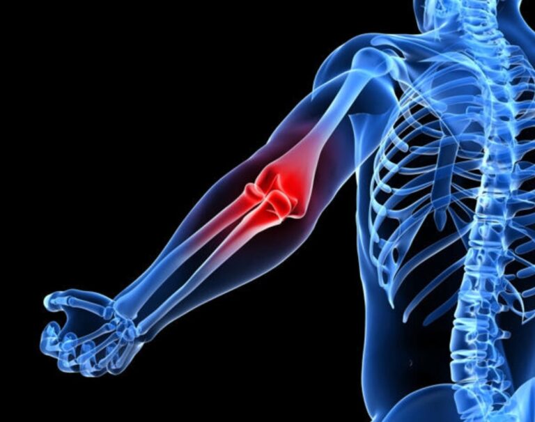 Anatomía del codo - Clínica Martín Gómez Traumatólogos